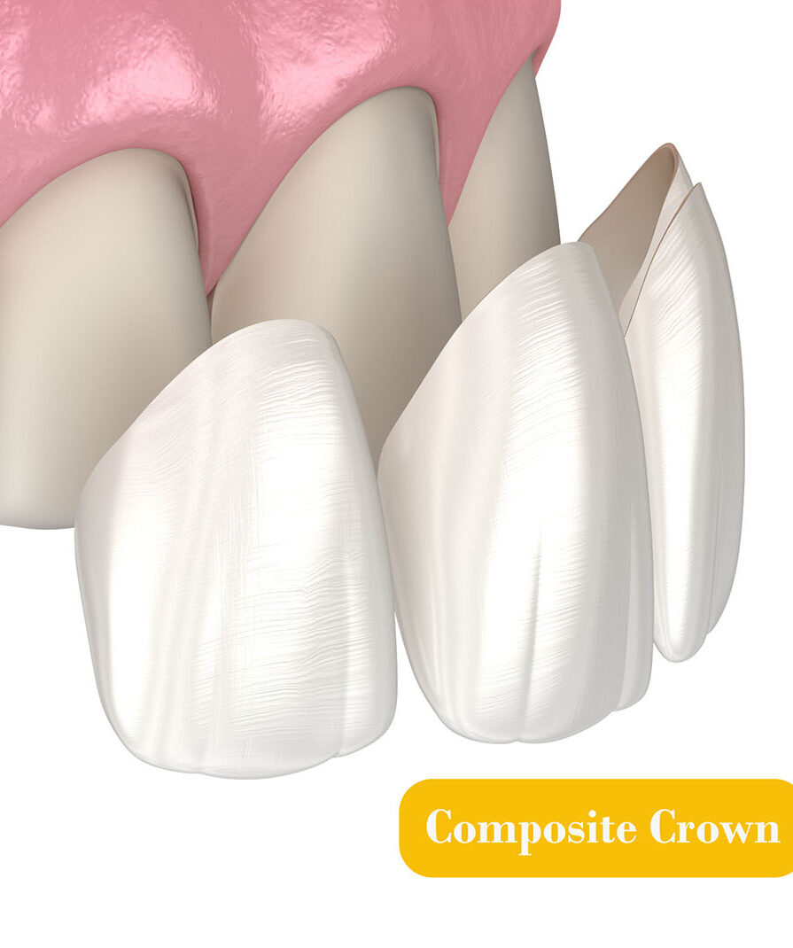 Kids Dental Care - Family Tree Dental Clinic