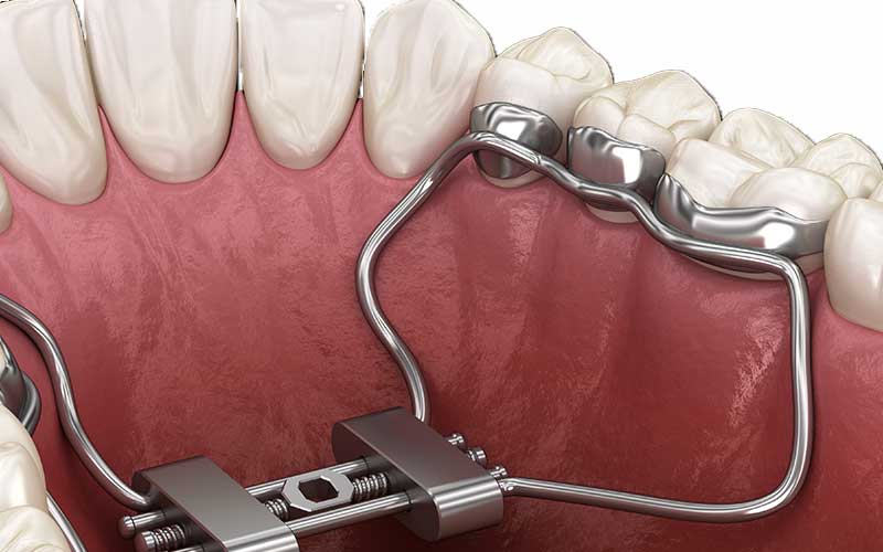 Kids Dental Care - Family Tree Dental Clinic